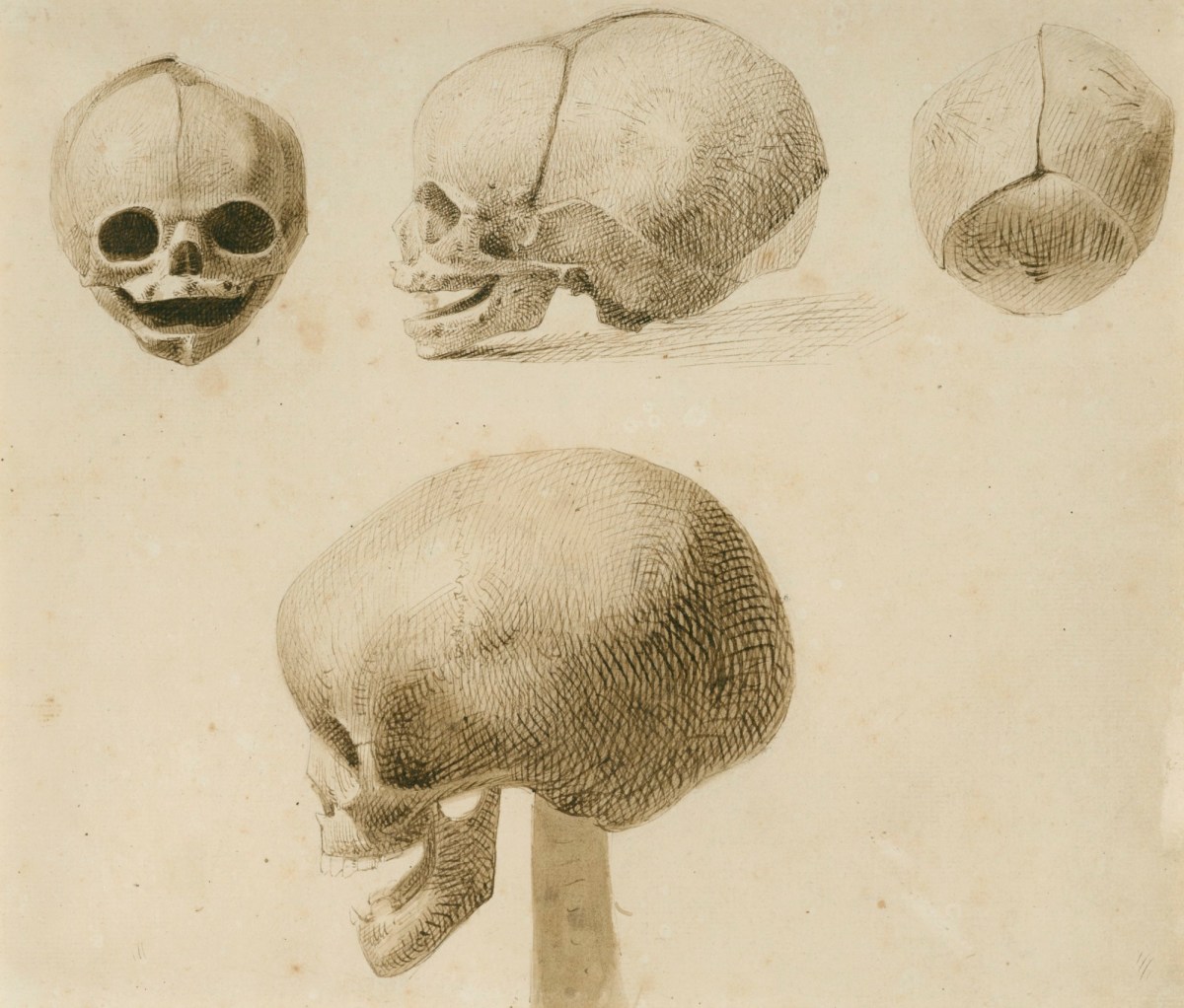 Studies of the skull of a child | Works of Art | RA Collection | Royal ...